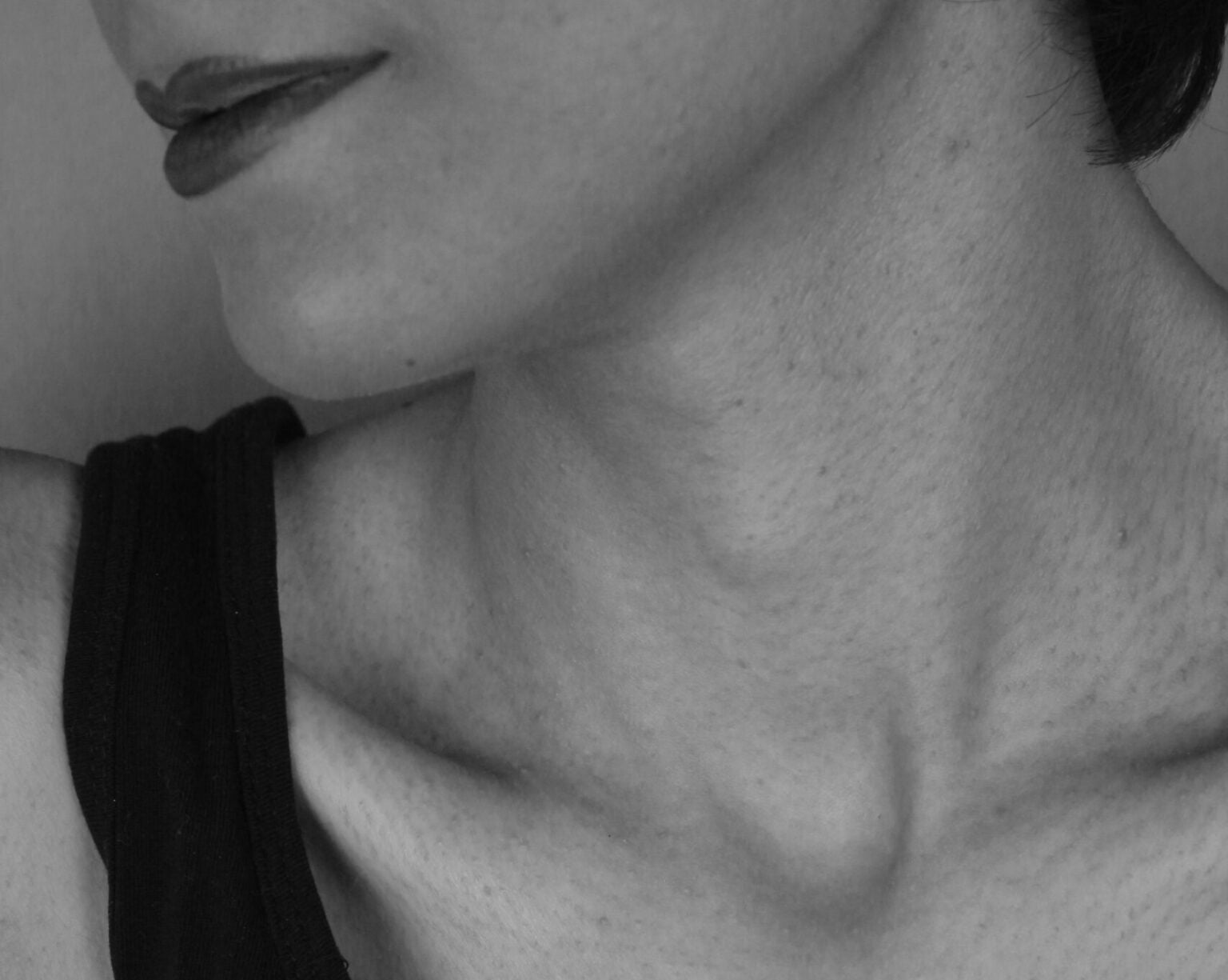Combatting the Signs of Aging: Neck Lift vs. Non-Invasive Alternatives